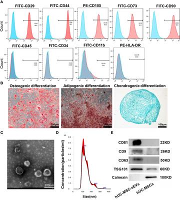 Frontiers | MSC-Derived Small Extracellular Vesicles Attenuate Autoimmune Dacryoadenitis by ...